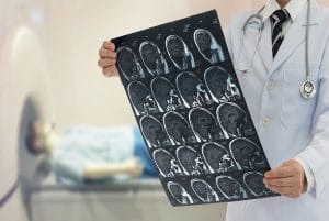 Apa Itu Radiologi dan Fungsinya untuk Kesehatan?