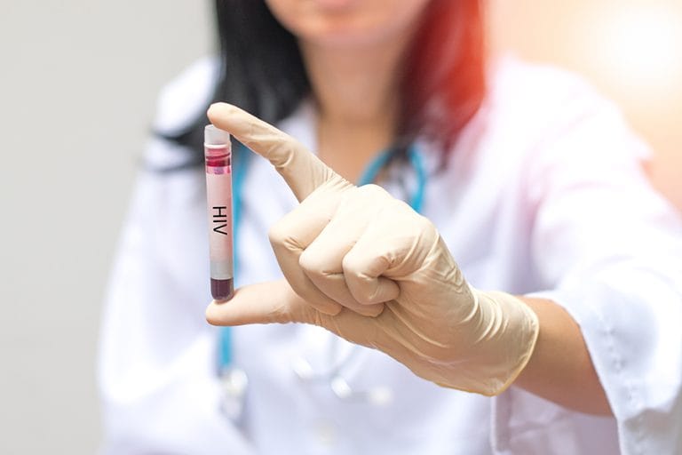 Bagaimana Cara Tes HIV di Rumah Sakit?