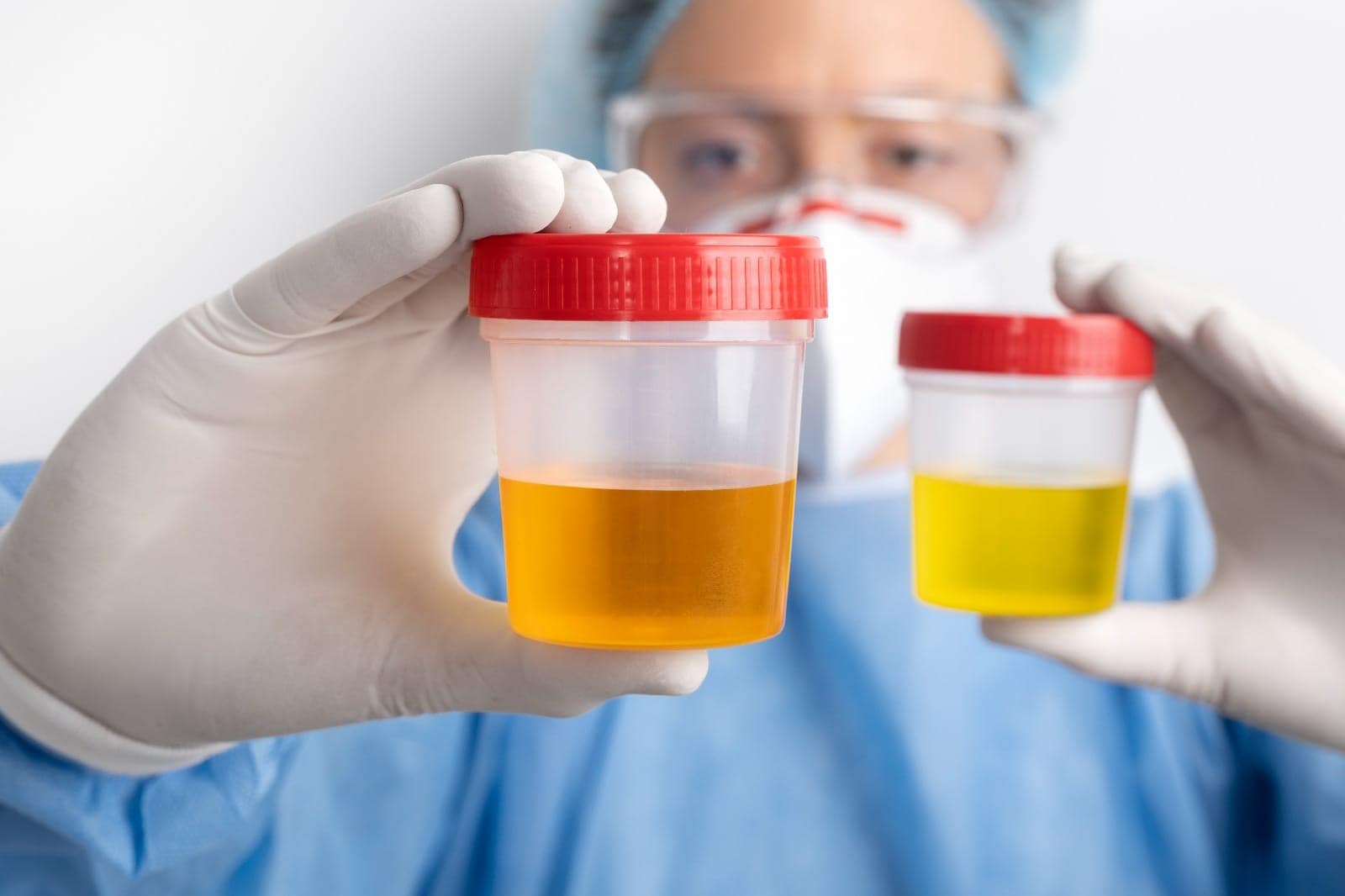 Arti Warna Urine Ibu Hamil: Kuning hingga Bening