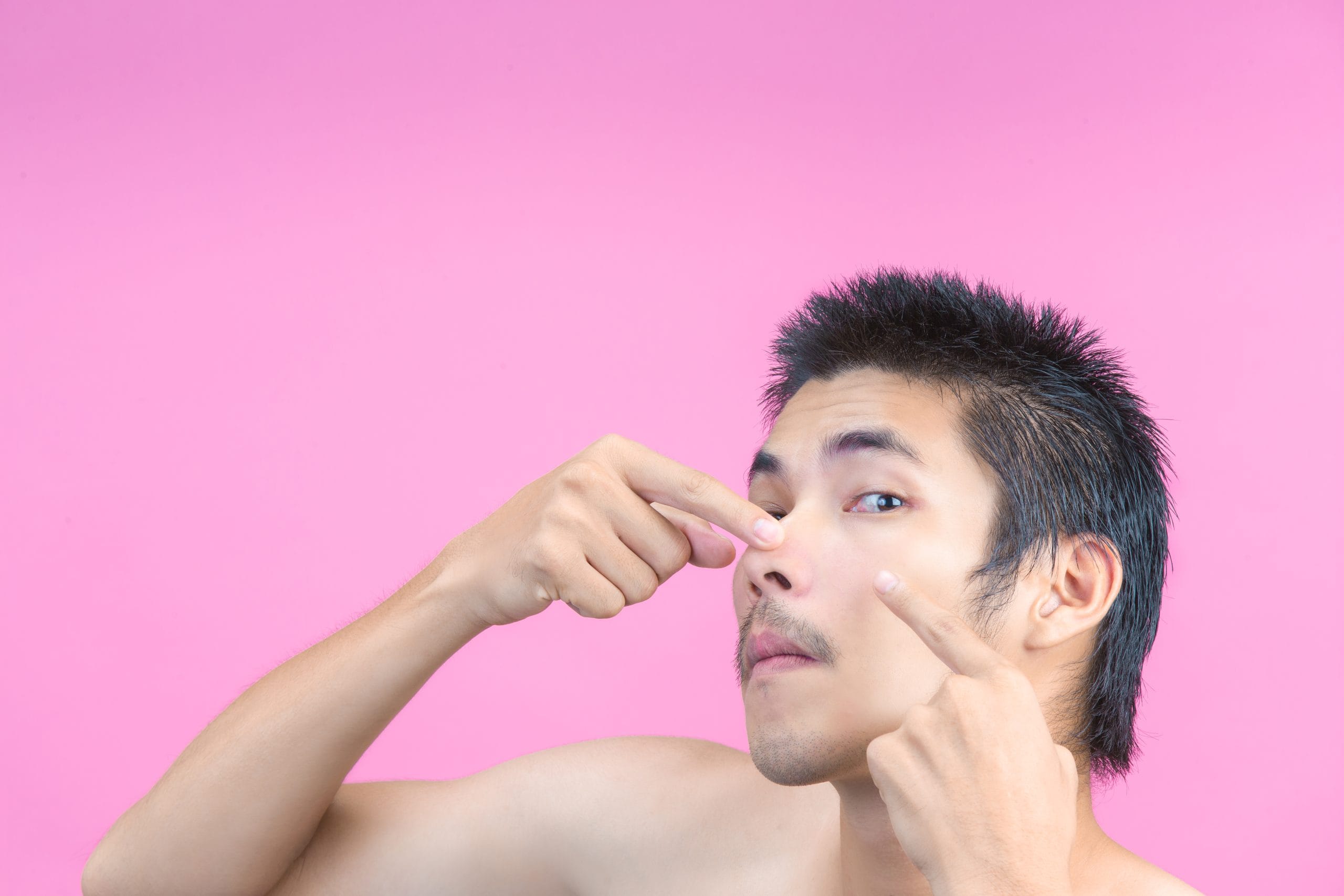 Penyebab Tulang Hidung Bengkok, Apakah Bisa Diluruskan?