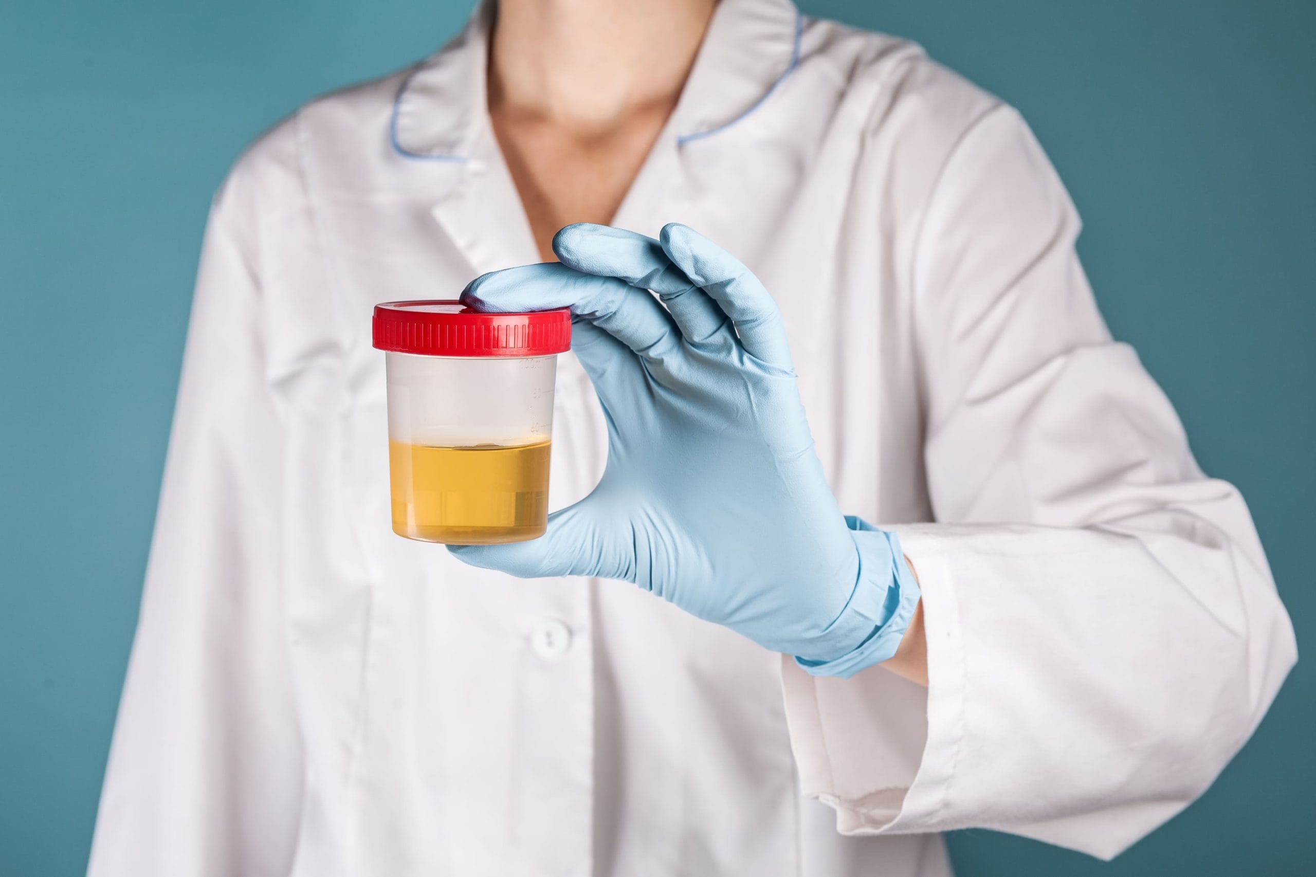 6 Ciri-Ciri Urine Tidak Normal, dari Warna hingga Baunya