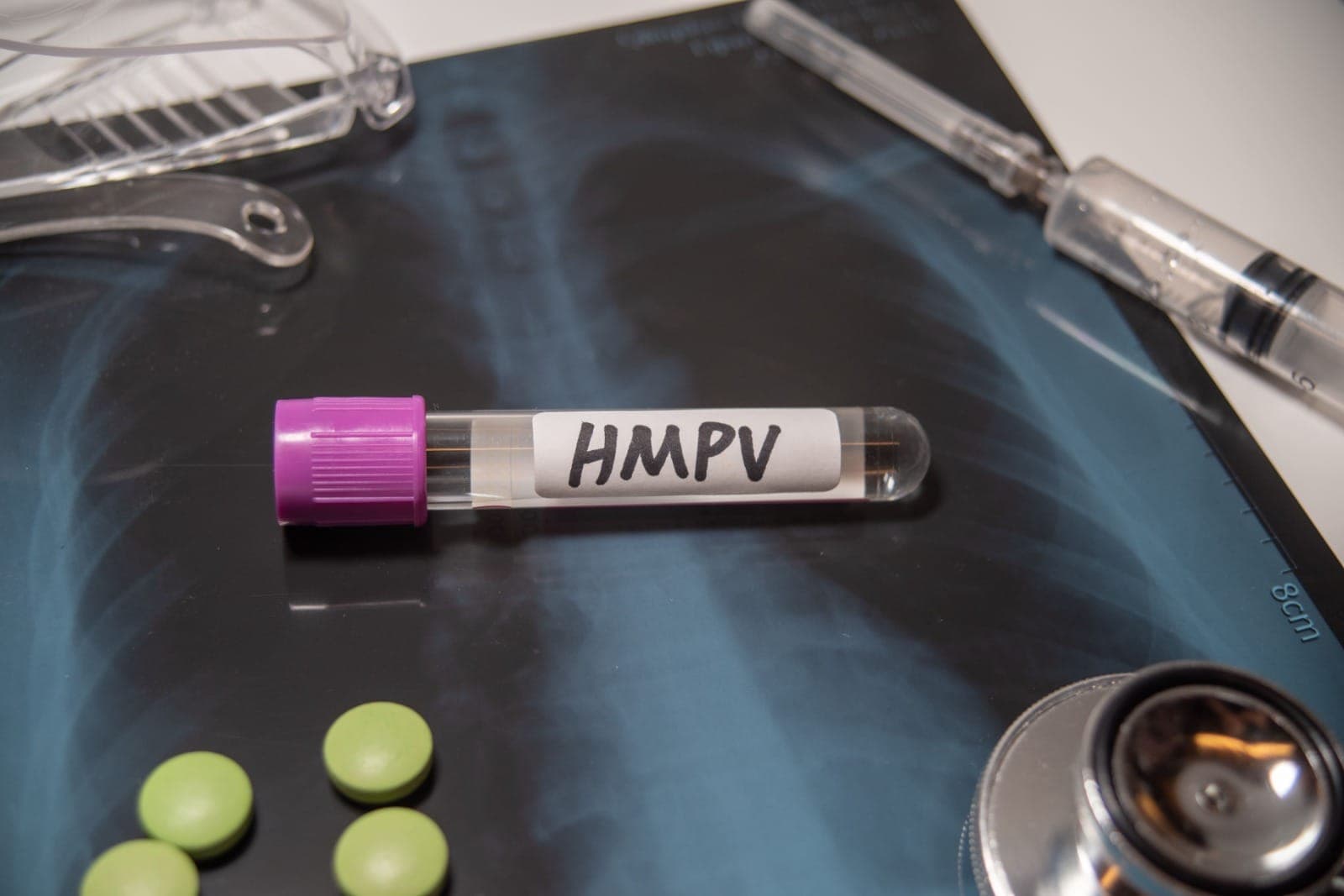 11 Fakta Virus HMPV yang Masuk di Indonesia