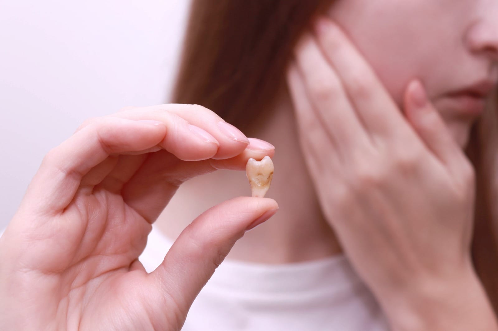 Cara Mengetahui Tanda Gigi Bungsu Bermasalah