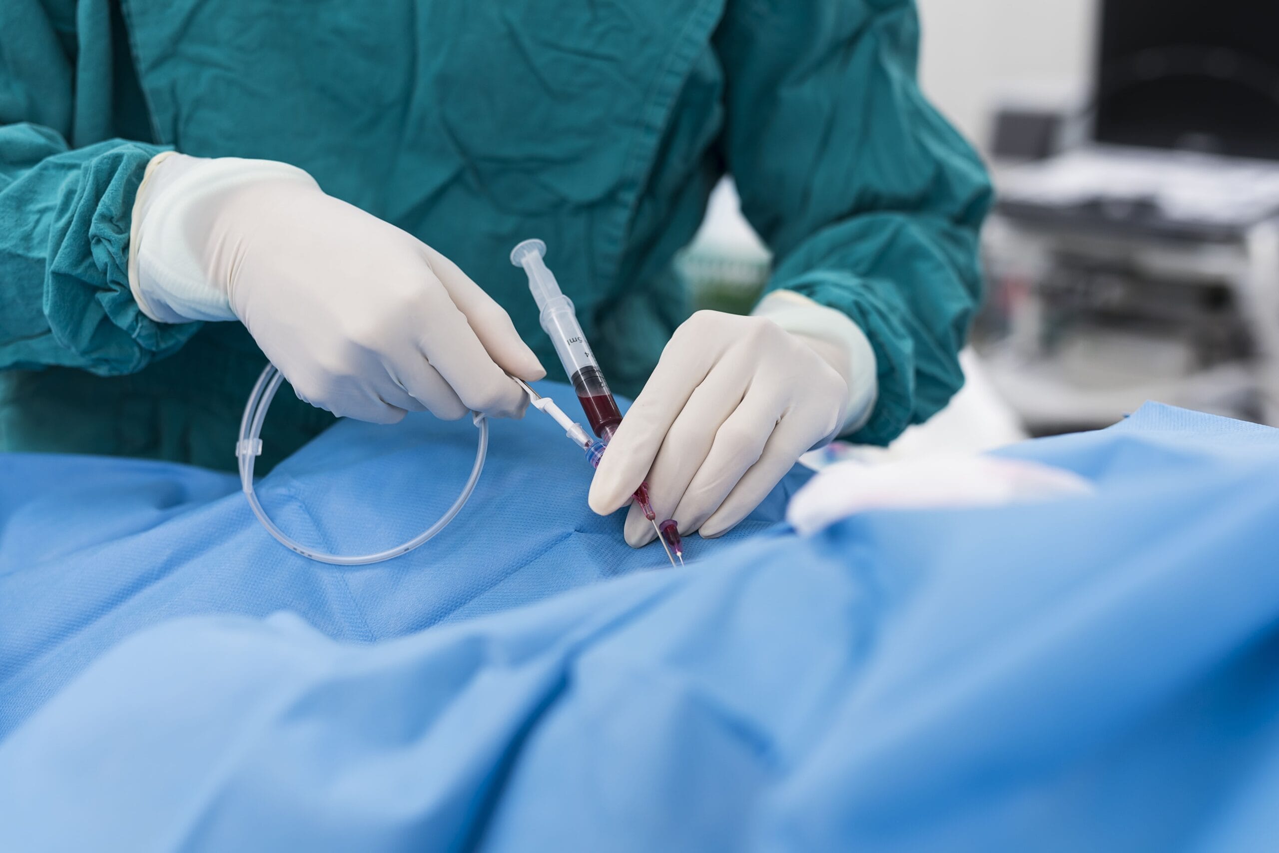 Perbedaan Kateterisasi Jantung dan Pasang Ring